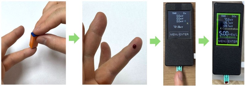 손끝 피 한 방울로 칼륨 측정…투석환자 자가관리 길 열린다 - 헬스케어저널